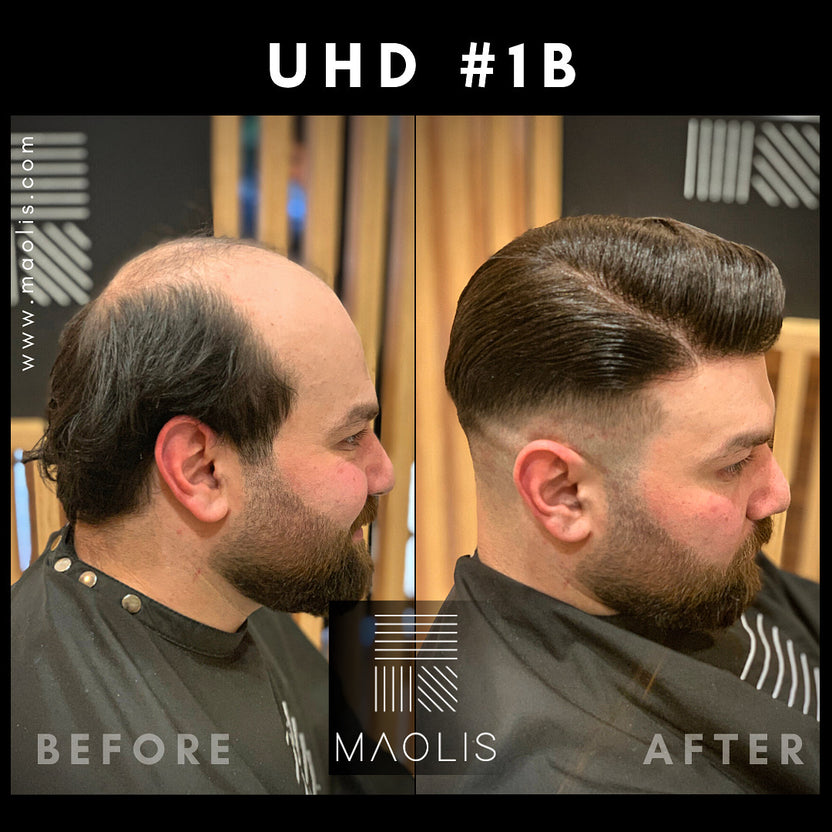 MAOLIS ULTRA-HD – Maolis